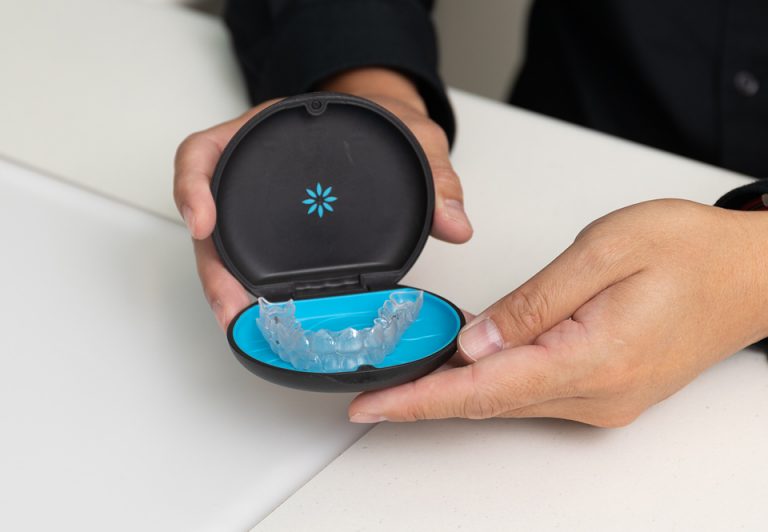 Overbite/Overjet: Causes, Symptoms & How is it Treated? « Smile Team ...