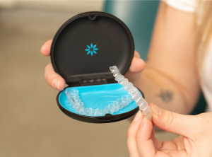 Crossbite Explained: Causes, Symptoms & Treatment Options for Children ...